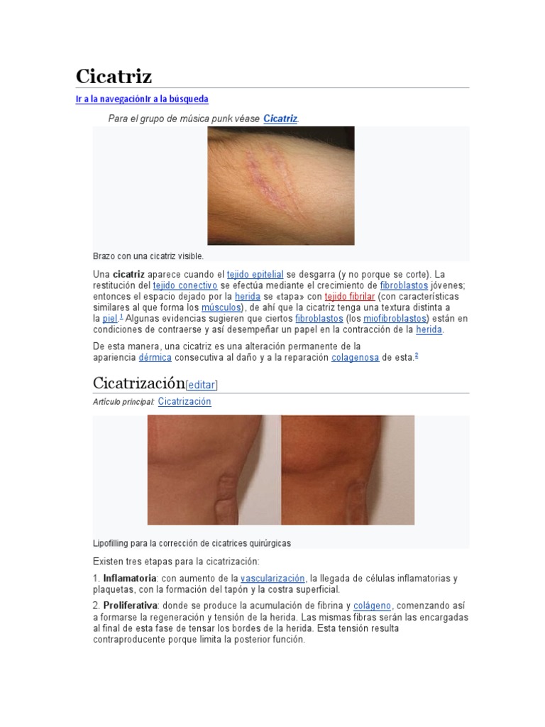 Esferas de Vida | PDF | Cicatriz | Pétalo