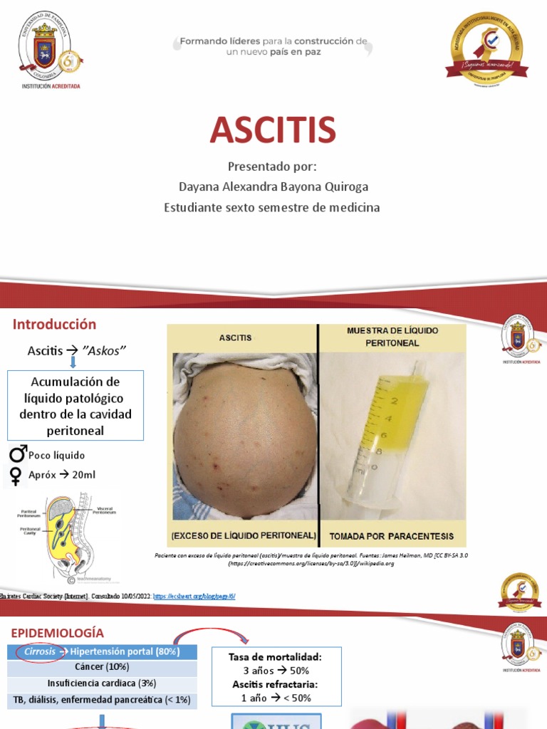 Ascitis: Causas, Síntomas y Tratamiento | PDF | Cirrosis ...