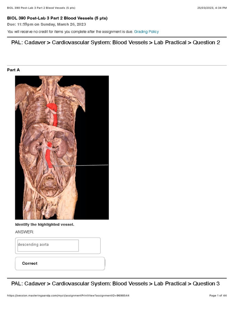 PAL: Cadaver Cardiovascular System: Blood Vessels Lab Practical ...
