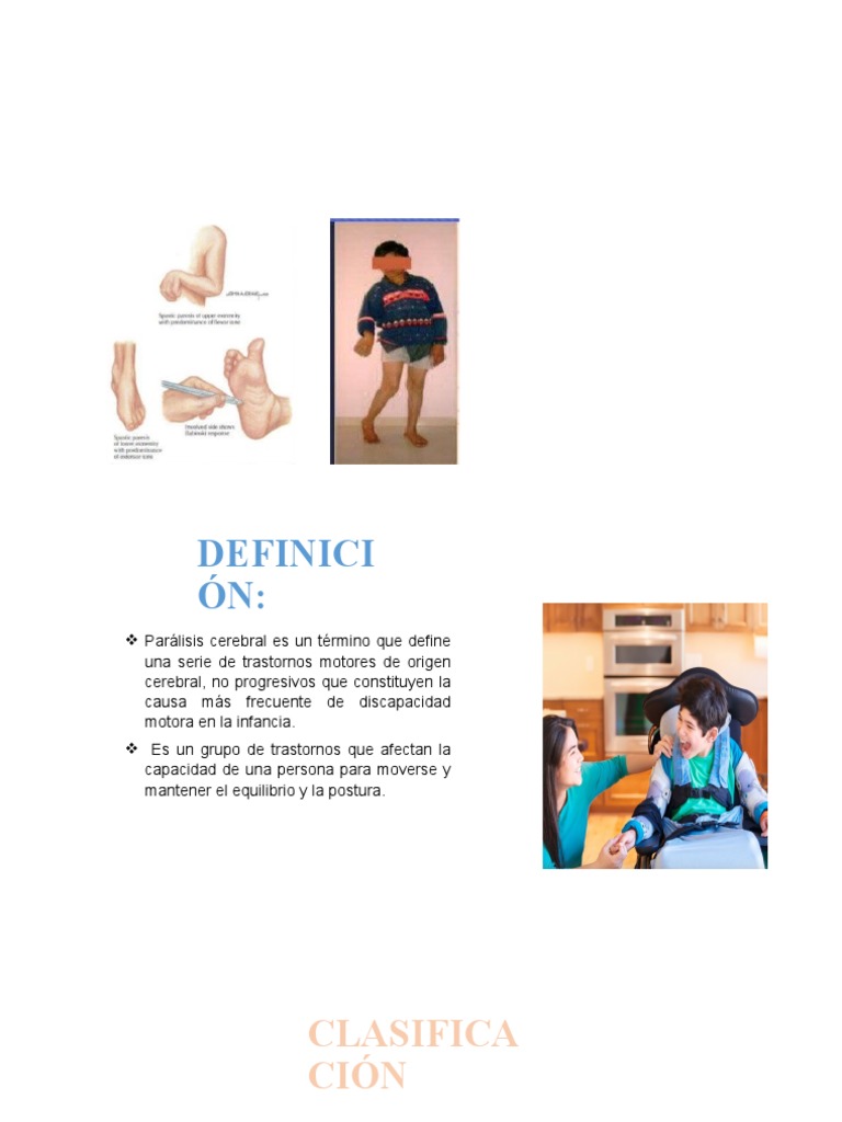 PCI ESPASTICA | PDF | Parálisis cerebral | Desórdenes neurológicos