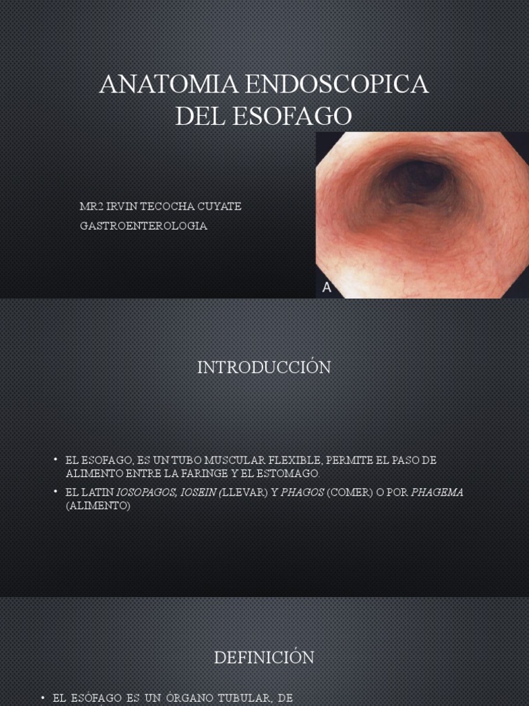Anatomia Endoscopica Del Esofago | PDF | Esófago | Estómago