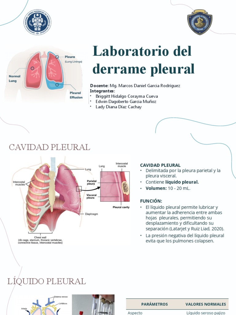 Derrame Pleural | PDF