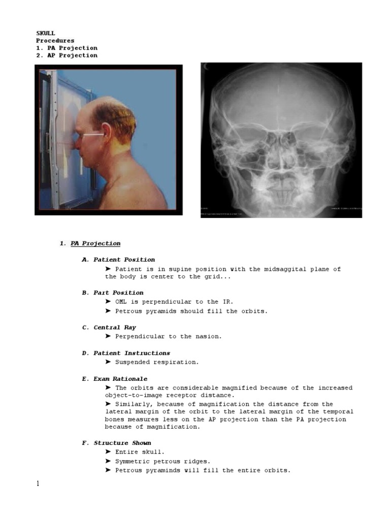 Skull Procedures 1. PA Projection 2. AP Projection | PDF | Human Nose ...