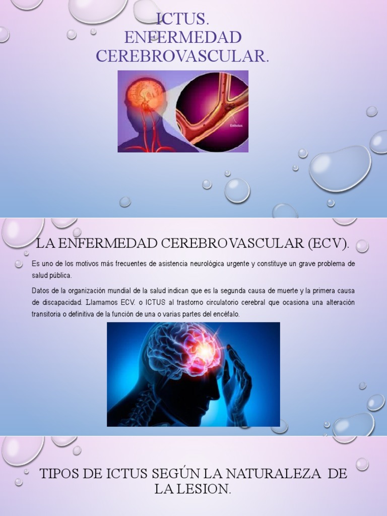 Ictus. Enfermedad Cerebrovascular | PDF | Carrera | Isquemia