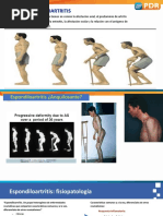 Lesiones Básicas. Osteofitos (Clases), Sindesmosfitos, Entesofitos ...