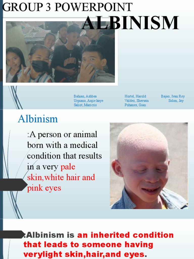 Group 3 Powerpoint-1 Albinism | PDF