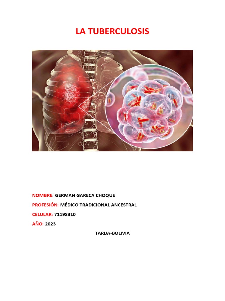 La Tuberculosis | PDF | Tuberculosis | Especialidades Medicas