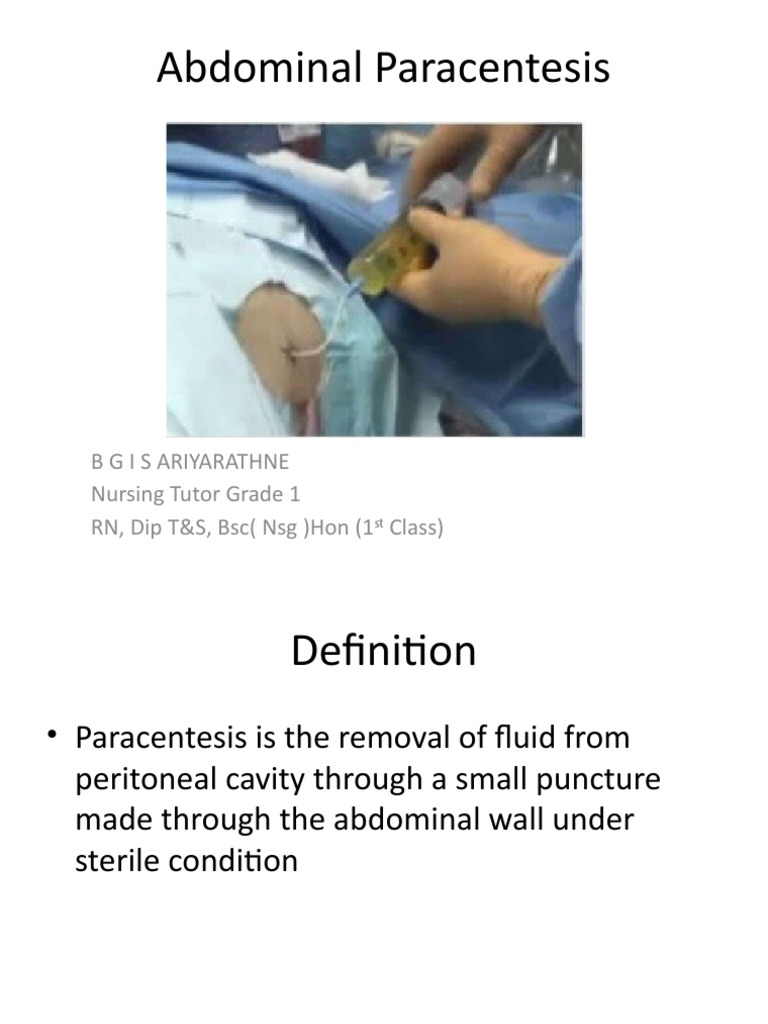 Abdominal Paracentesis Fundamentas of Nursing | PDF