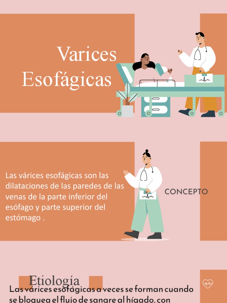 Varices Esofágicas | PDF | Cirrosis | Hígado