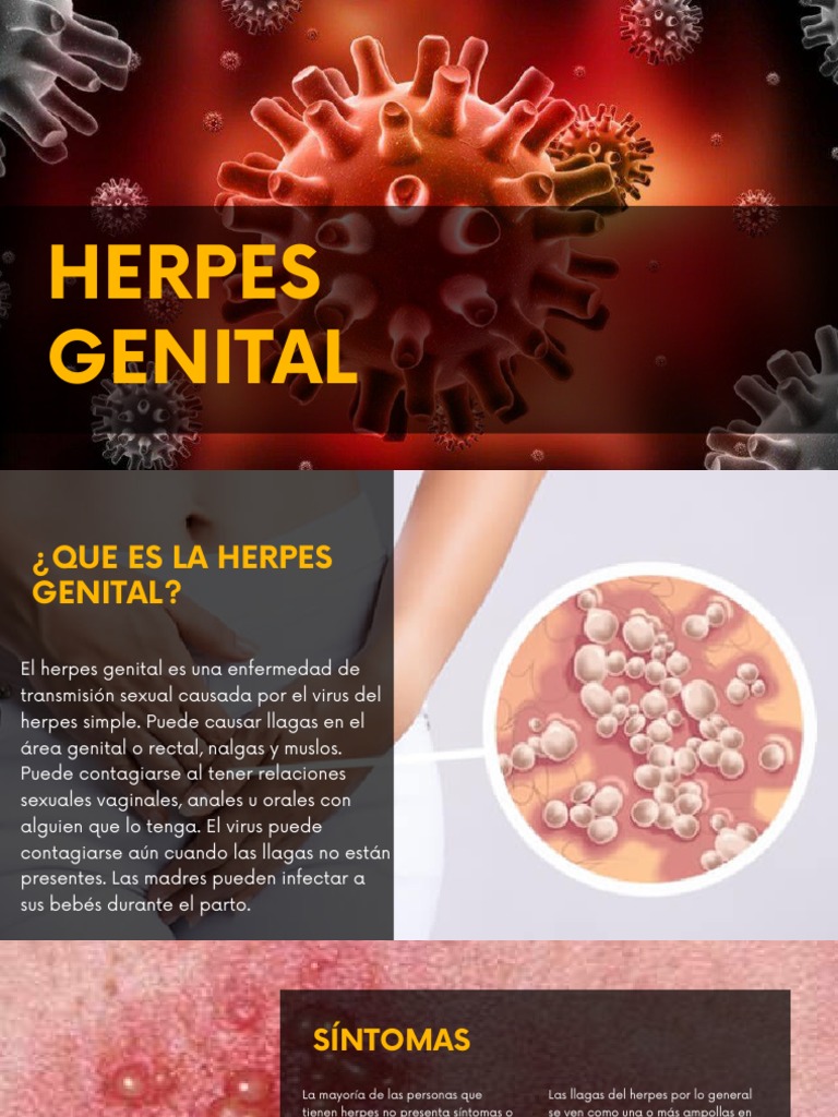 Herpes Genital | PDF | Herpes Simple | Enfermedades virales