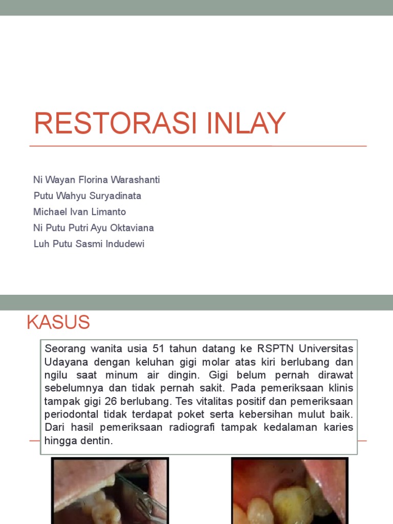 Prosedur Restorasi Inlay Gigi Molar | PDF