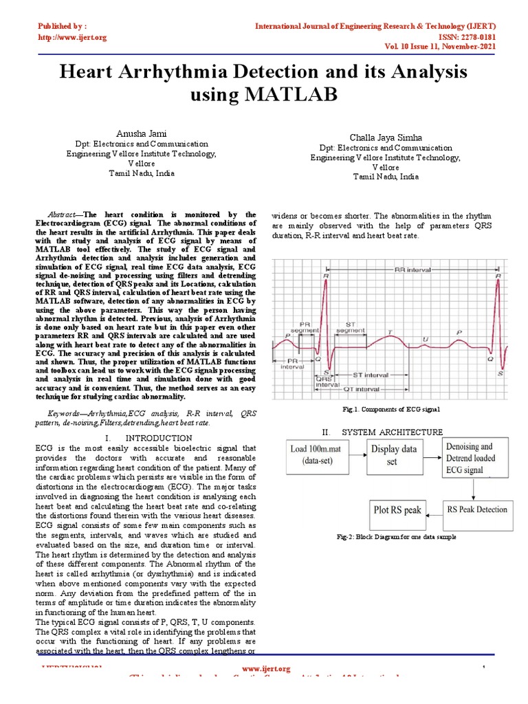 Heart Arrhythmia Detection And Its Analysis Using Matlab Ijertv10is110176 Download Free Pdf