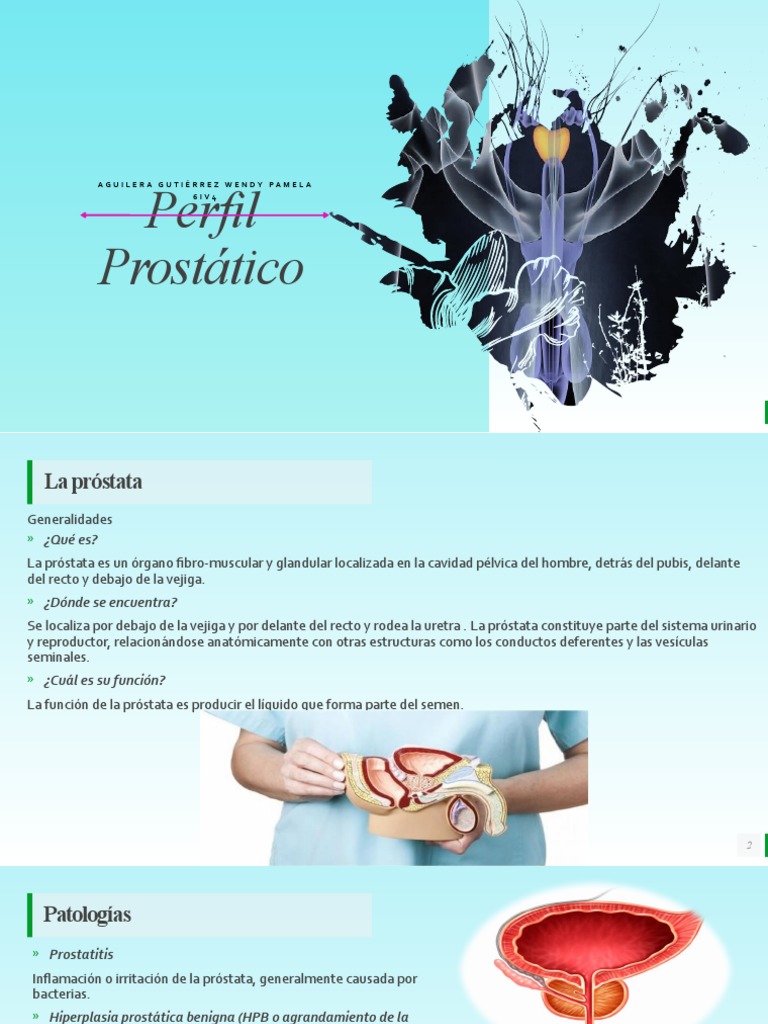 Perfil Prostatico Wendy Aguilera 6IV4 | PDF | Cancer de prostata | Próstata