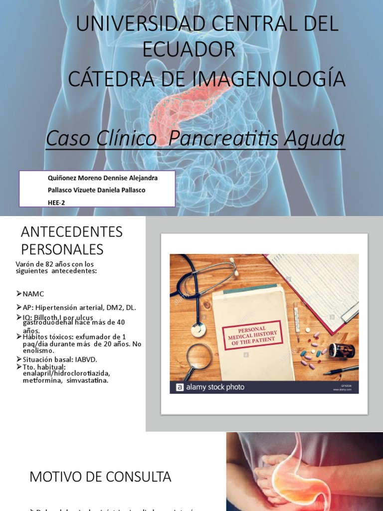 Caso Clinico Grupo 6 Pancreatitis Aguda | PDF | Medicina CLINICA | Causas de la muerte