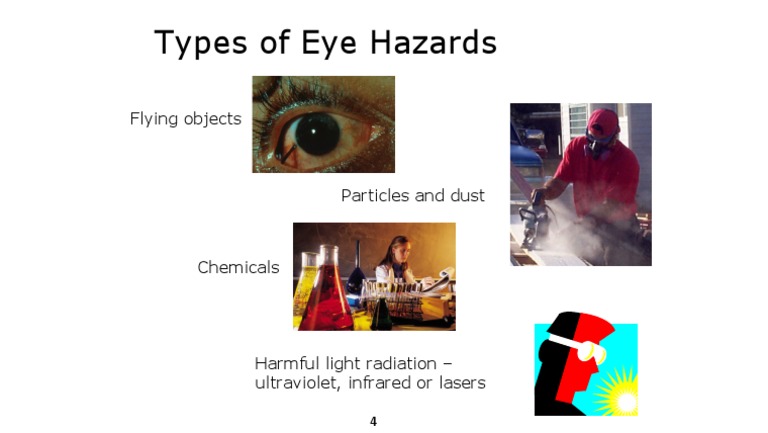 Types of Eye Hazards | PDF