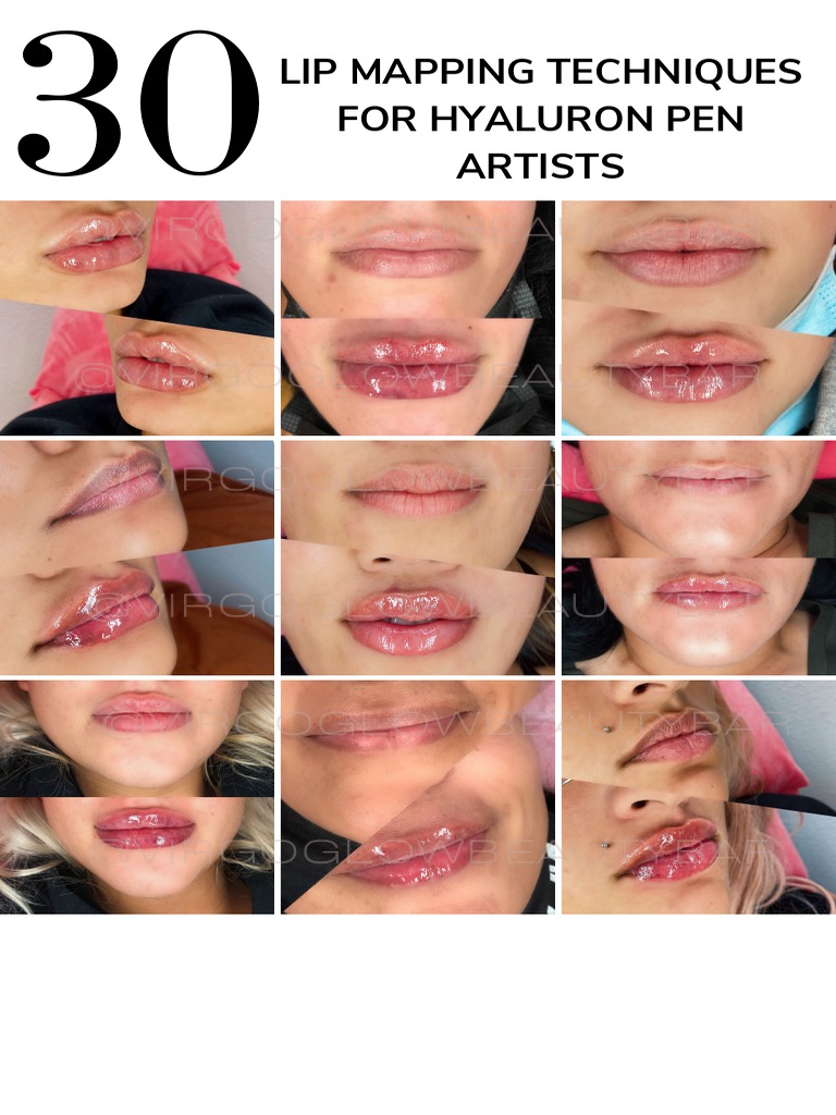 @virgoglowbeautybar: Lip Mapping Techniques For Hyaluron Pen Artists ...