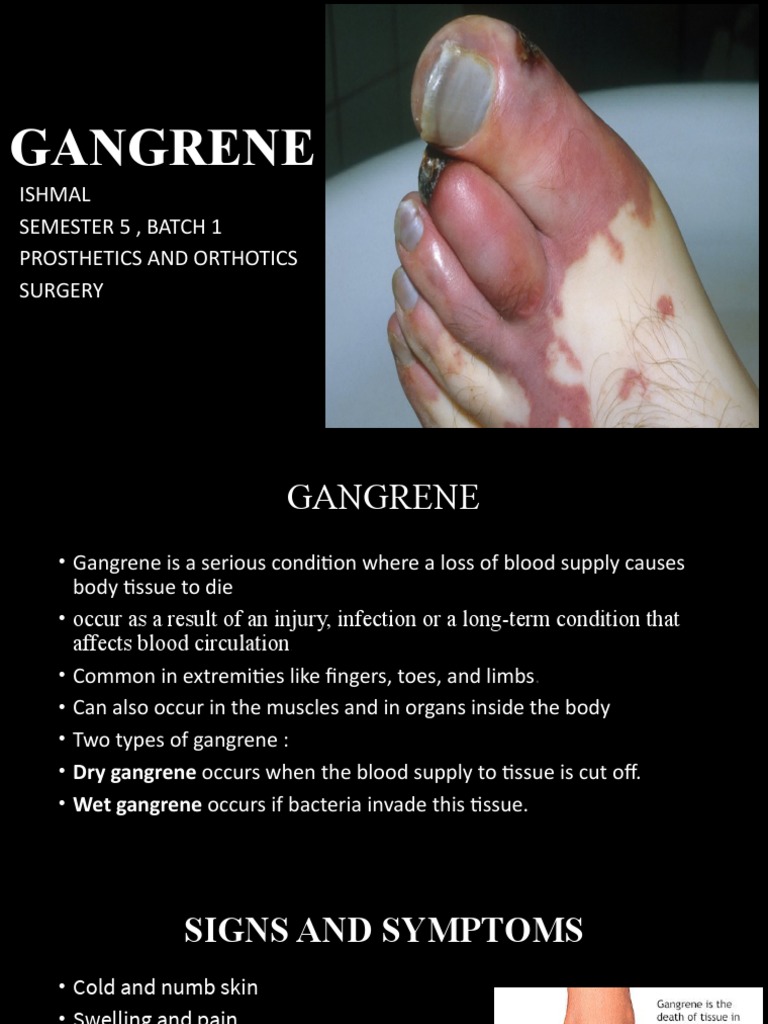 Understanding Gangrene: Causes and Treatment | PDF