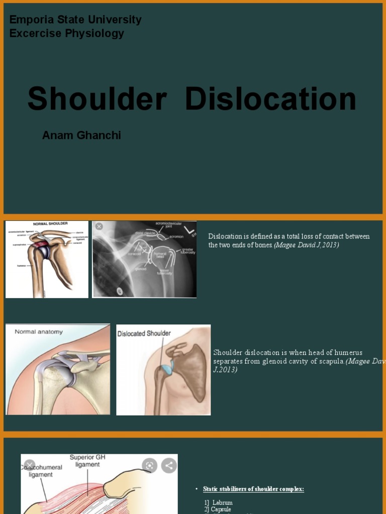 Rehabilitation OF Atheletes With Shoulder DISLOCATION | PDF ...