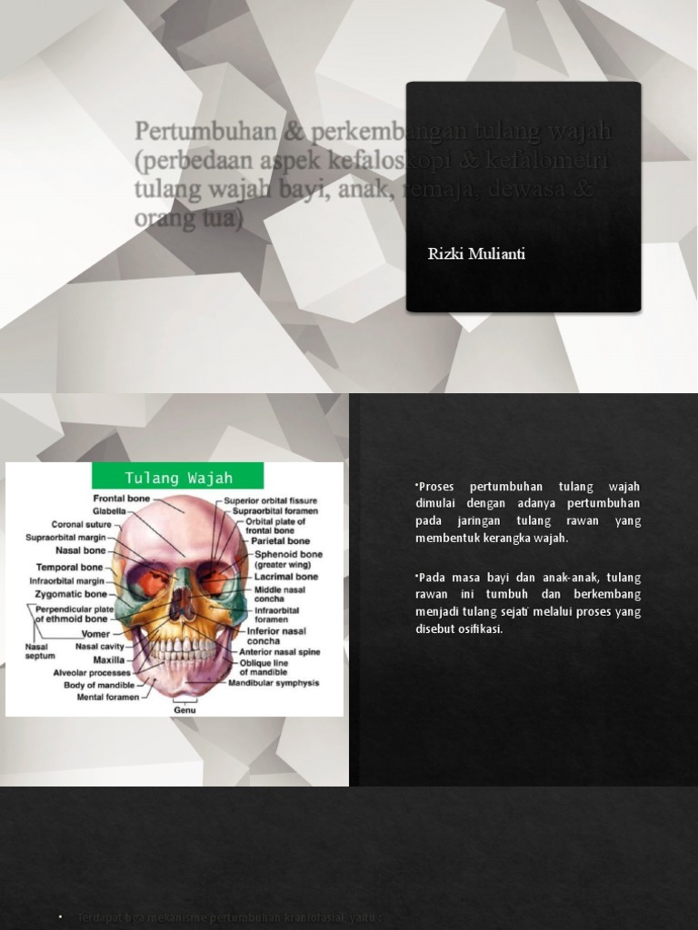 Presentasi Kefaloskopi Kefalometri | PDF