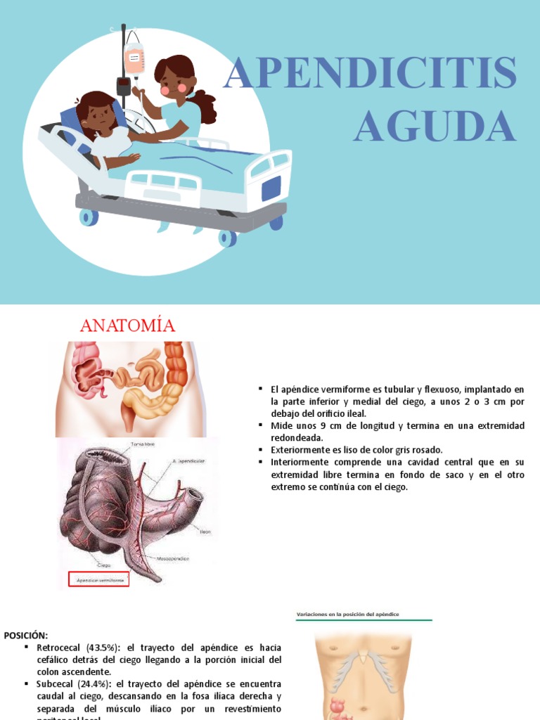 Signos y fases de apendicitis aguda | PDF | Especialidades Medicas ...