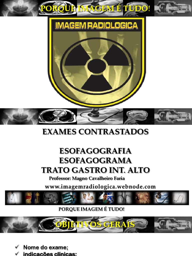 Exames Contrastados: Esofagografia Detalhada | PDF | Vômito | Esôfago