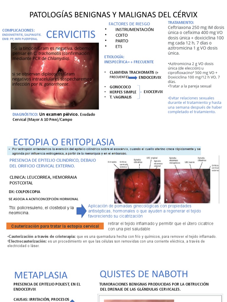 Benignas Cervix | PDF | Cáncer | Anatomía