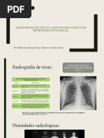 Interpretacion de Radiografia de Torax | PDF