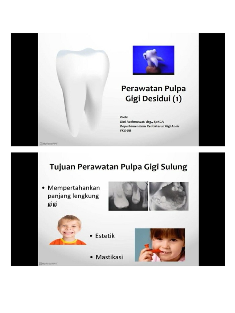 1 - IKGA Perawatan Pulpa Gigi Desidui | PDF