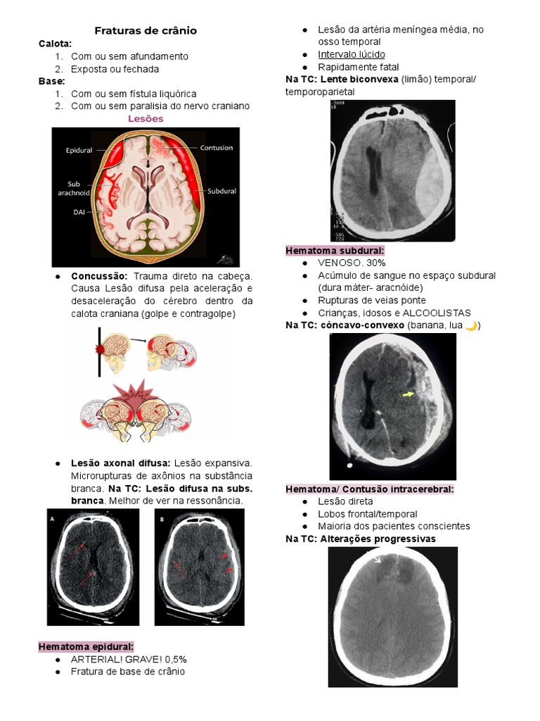 Resumo TCE e Fraturas de Crânio | PDF | Traumatismo craniano ...