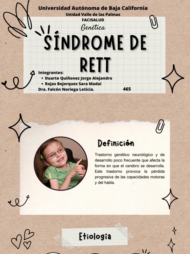 Síndrome de Rett PDF | PDF