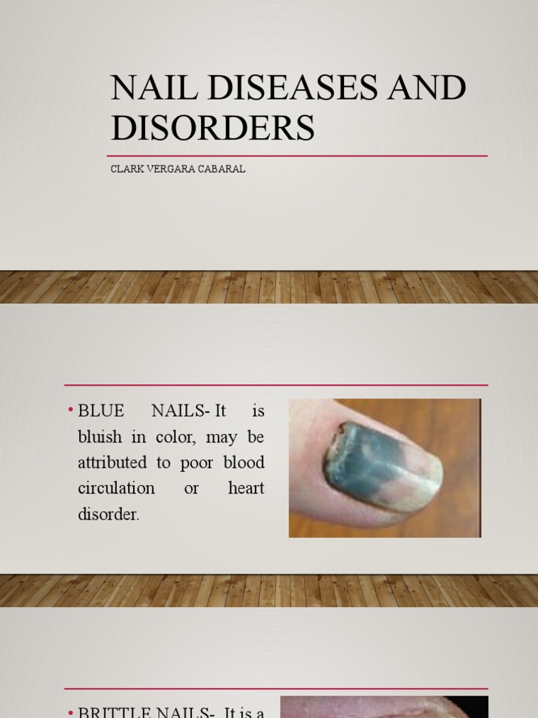 Nail Diseases and Disorders | PDF