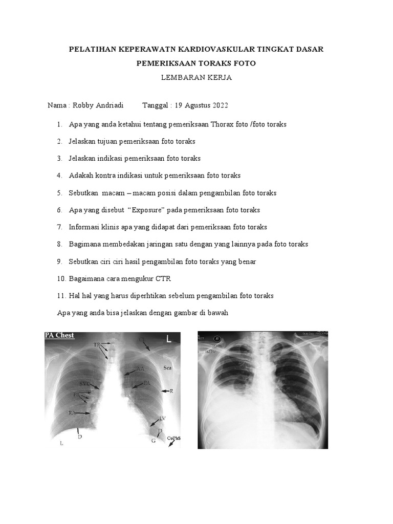 Panduan Pemeriksaan Foto Toraks | PDF