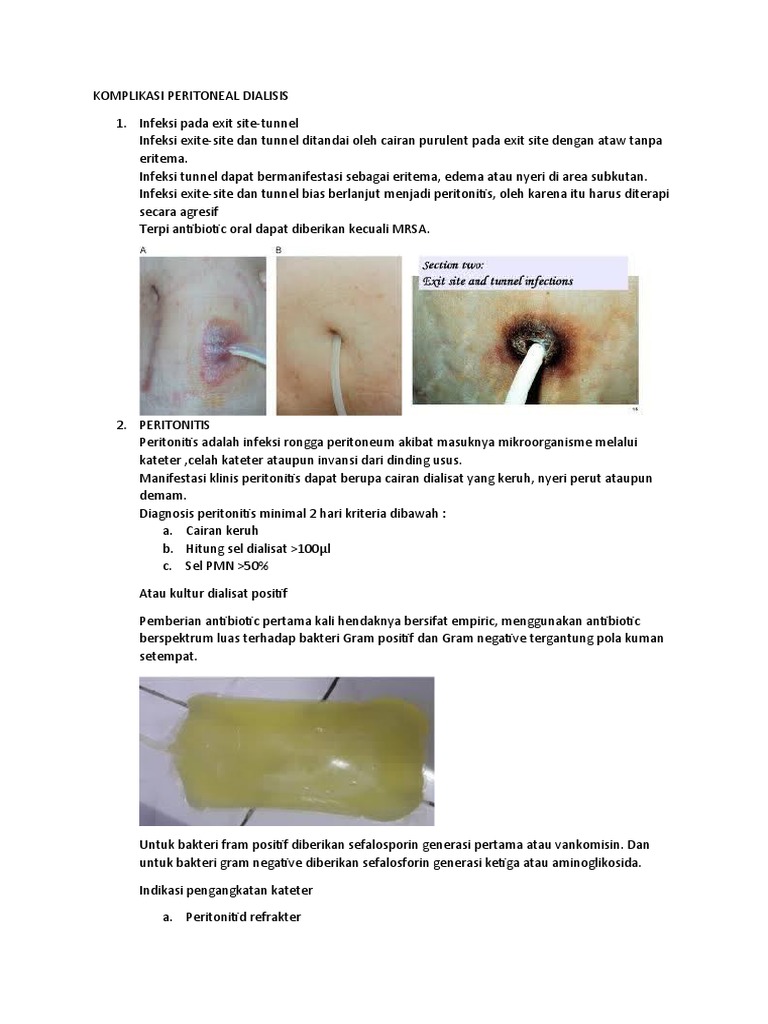 Komplikasi Peritoneal Dialisis dan Perawatannya | PDF