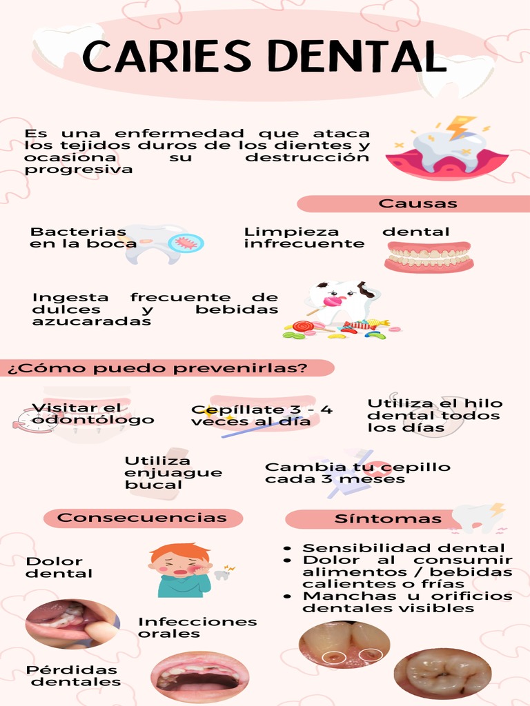 Caries Dental | PDF