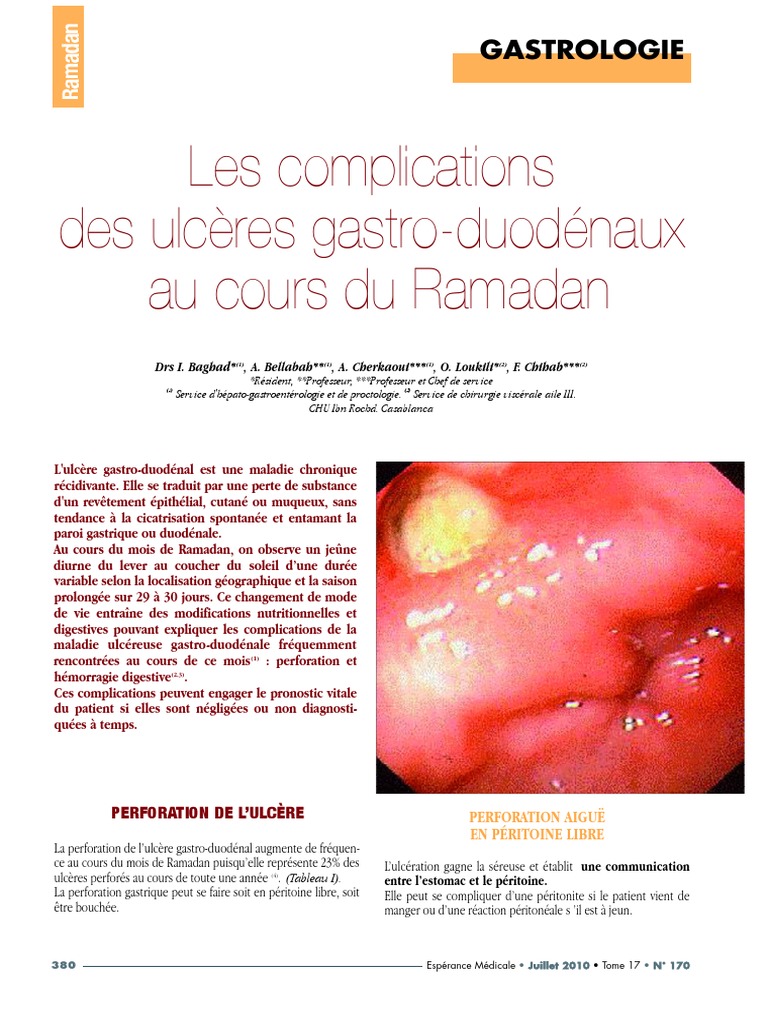 Complications des ulcères au Ramadan | PDF | Gastroentérologie ...