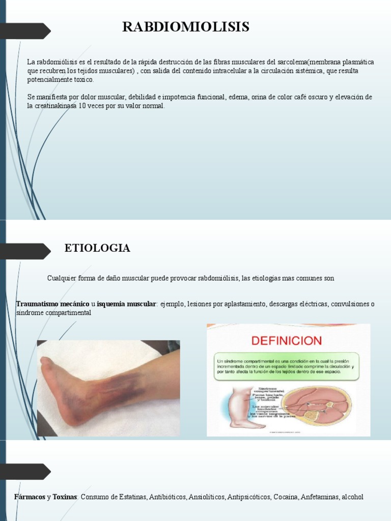 Rabdomiólisis: Causas, Diagnóstico y Tratamiento | PDF | Especialidades ...