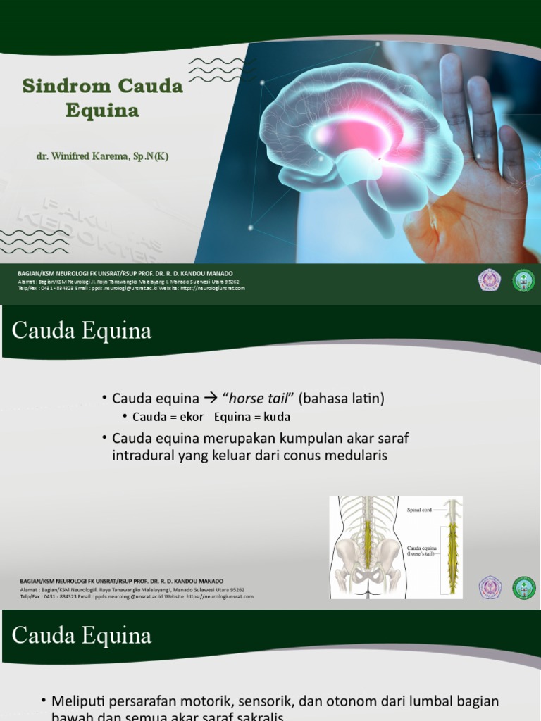Sindrom Kauda Equina | PDF