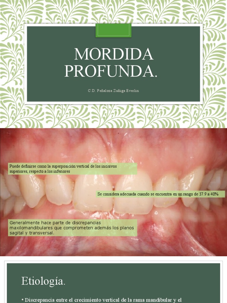 Mordida Profunda | PDF