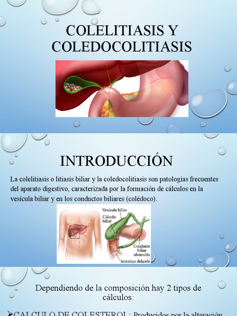 Colelitiasis y Coledocolitiasis | PDF | Hogar, jardinería y bricolaje