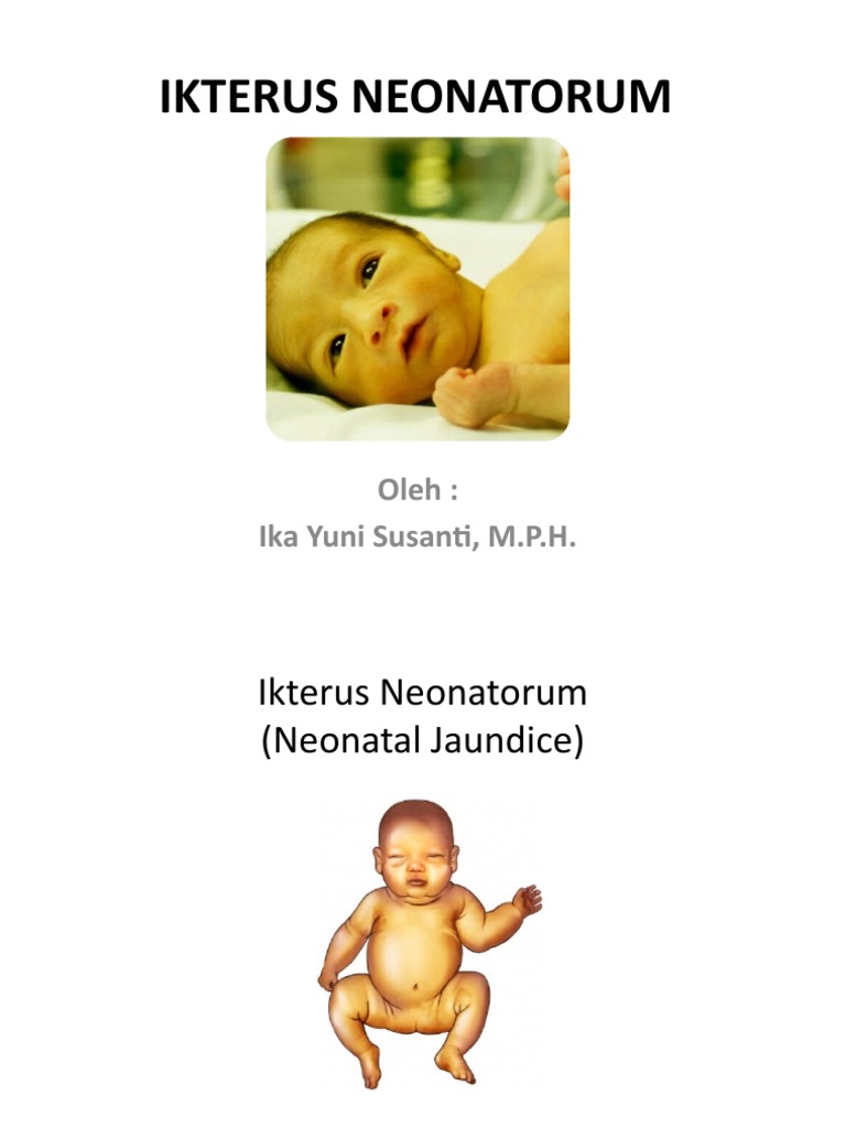 Ikterus Neonatorum | PDF