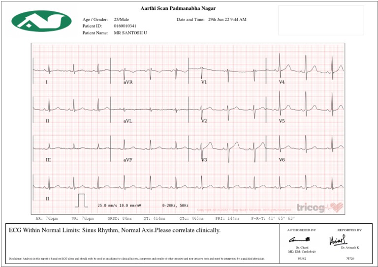ECG Report: Normal Sinus Rhythm | PDF