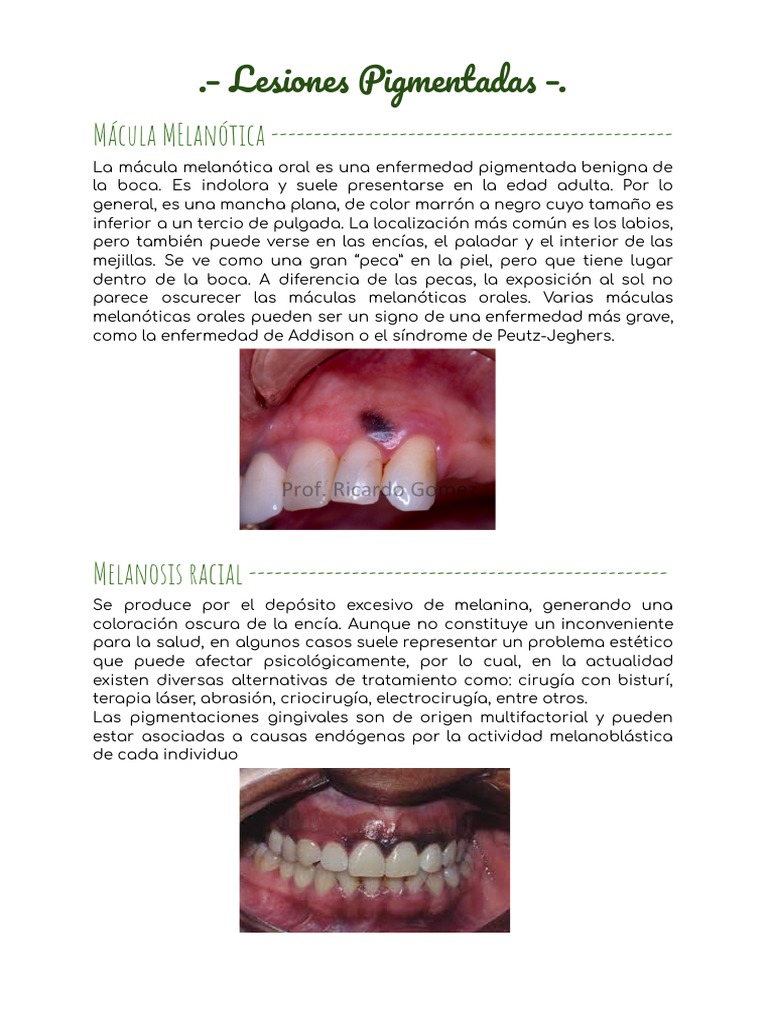 Lesiones Pigmentadas PDF | PDF