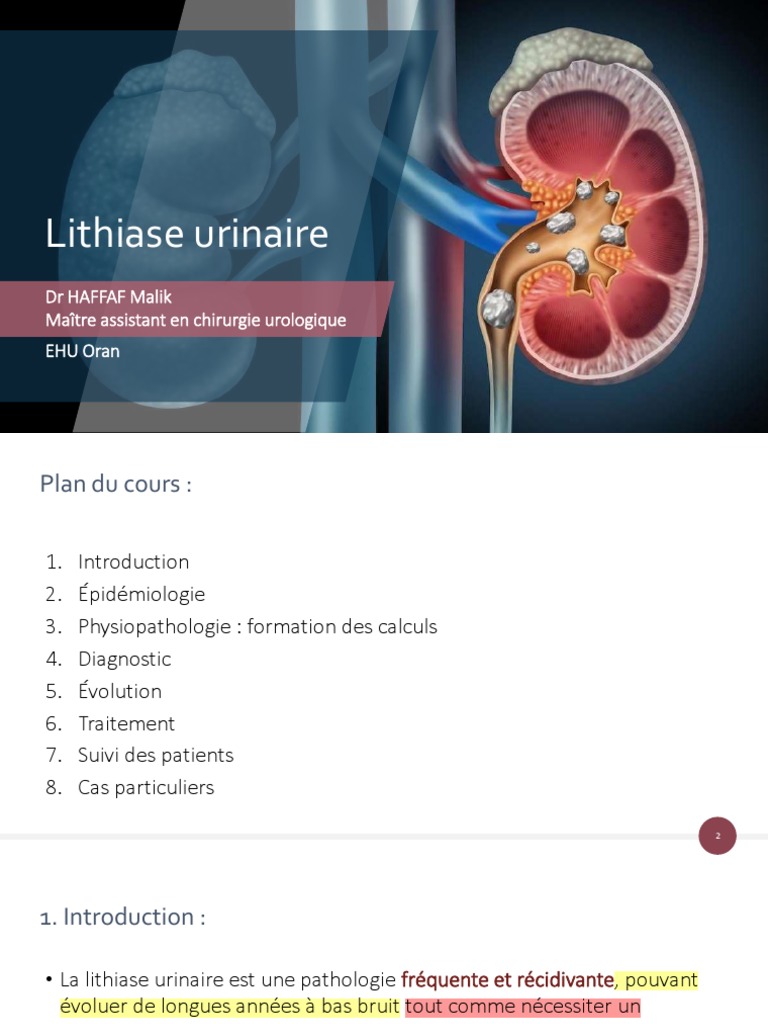 Lithiase urinaire : diagnostic et traitement | PDF | Bien-être ...