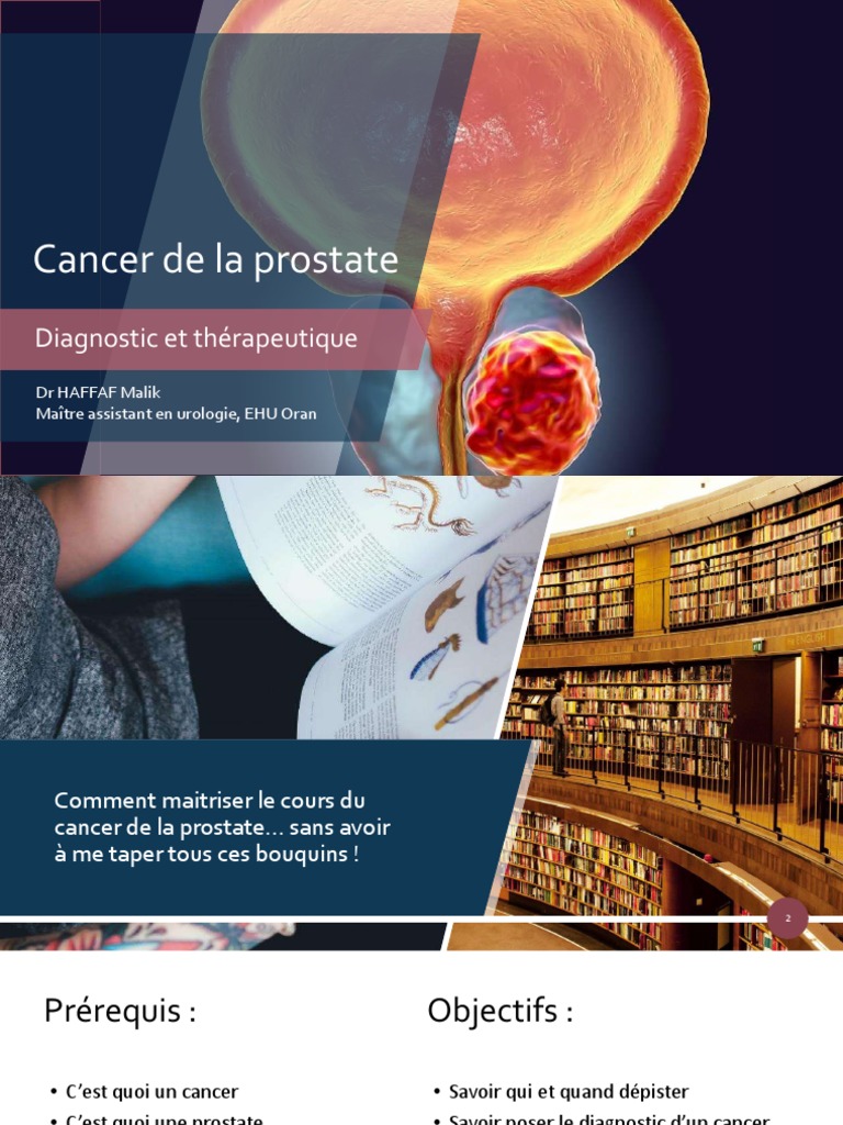 Approche du cancer de la prostate | PDF