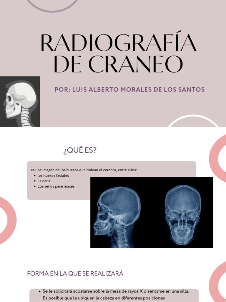 Radiografía de Cráneo PDF | PDF