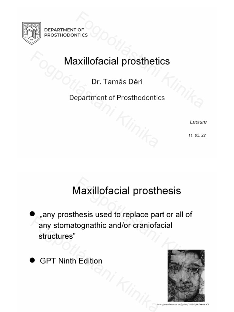 An Overview of Maxillofacial Prosthetics: Defect Classification ... An Overview of Maxillofacial Prosthetics: Defect Classification ...