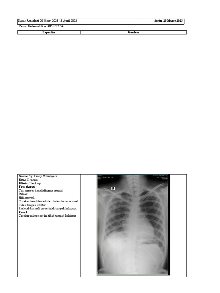 Kasus Radiologi Normal Maret 2023 | PDF
