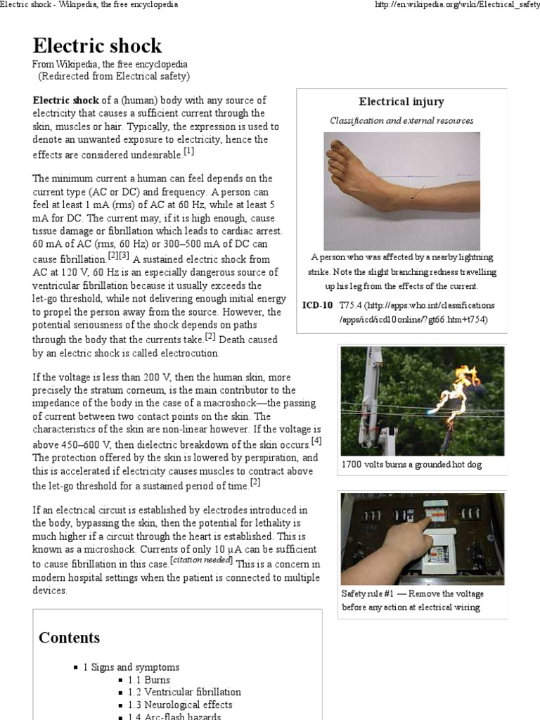 Electric Shock - Wikipedia, The Free Encyclopedia | PDF | Electricity ...