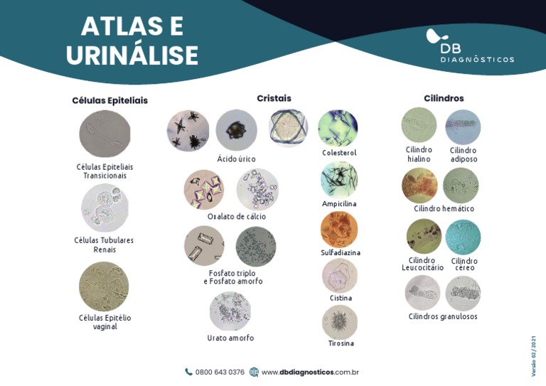 Atlas de Urinálise Completo | PDF