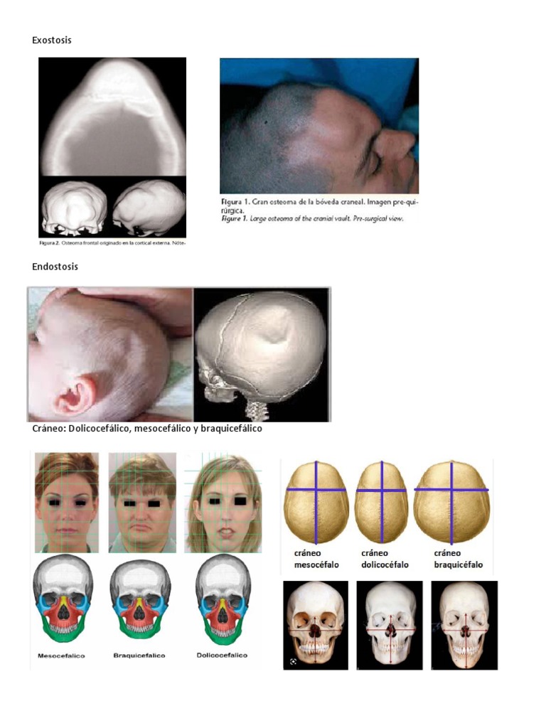 Exploración Cabeza y Cuello PDF | PDF